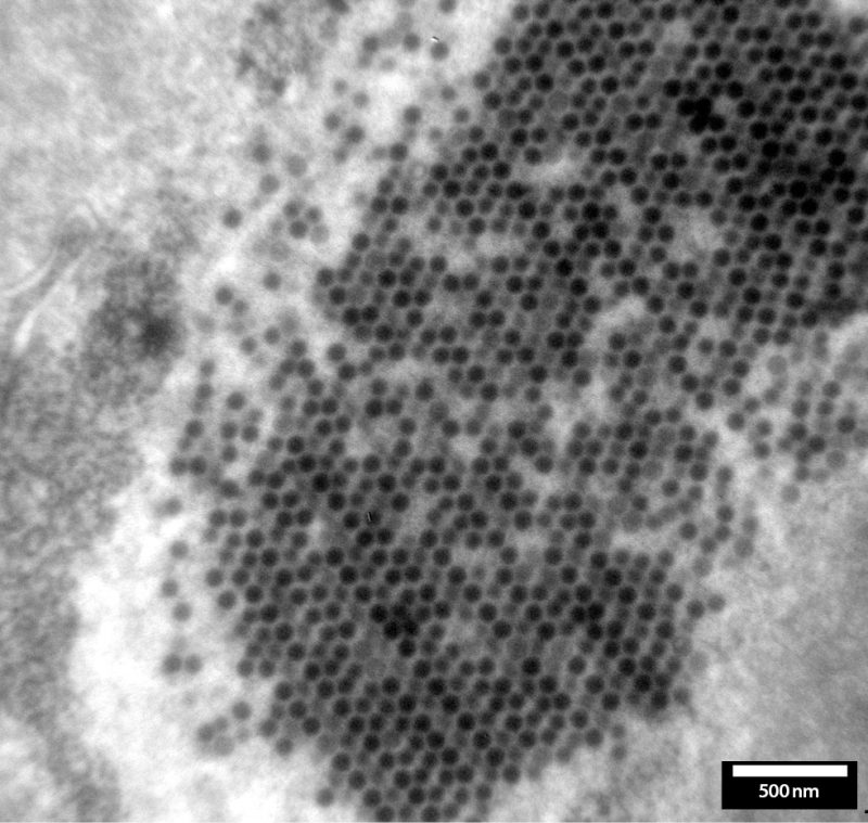 Exploring cell biology with transmission electron microscopy (TEM ...