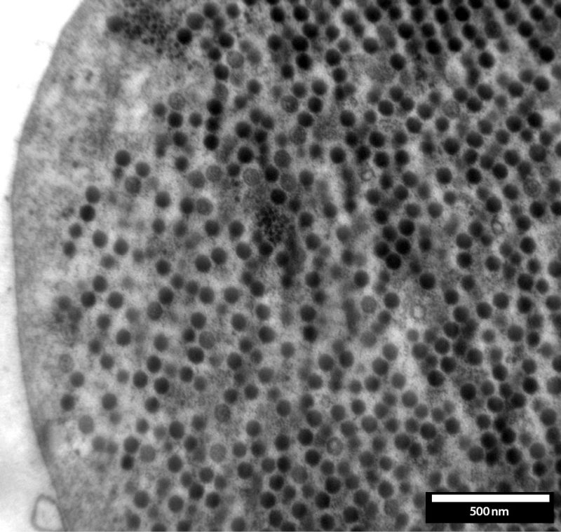 Exploring cell biology with transmission electron microscopy (TEM ...
