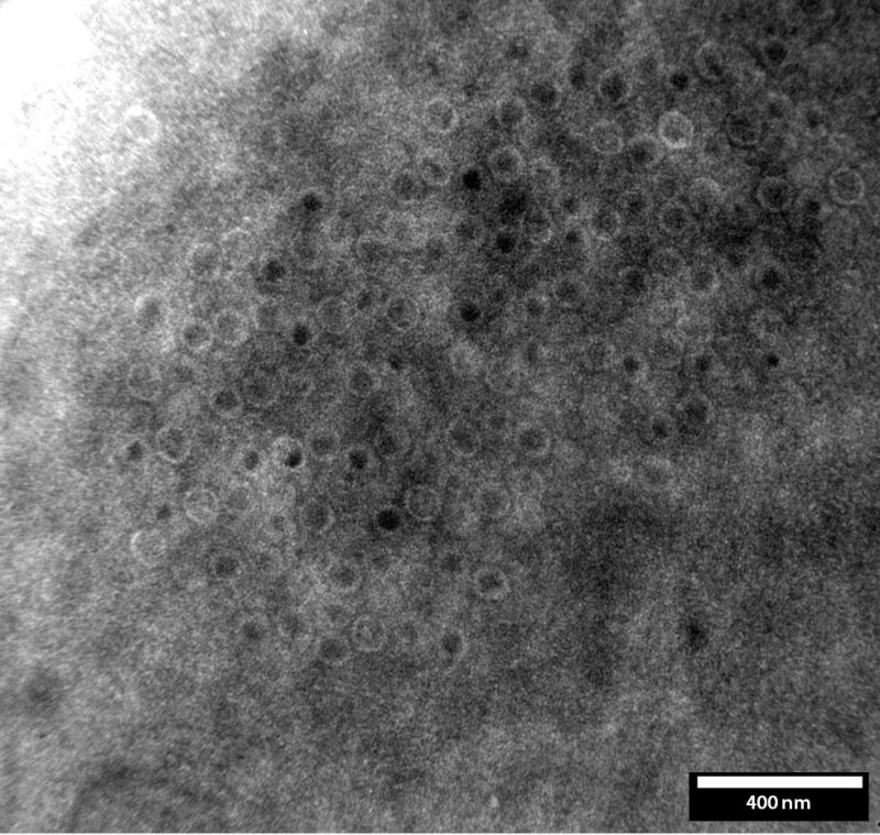 Exploring cell biology with transmission electron microscopy (TEM ...